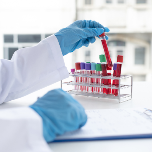 Magas CRP - Immunközpont